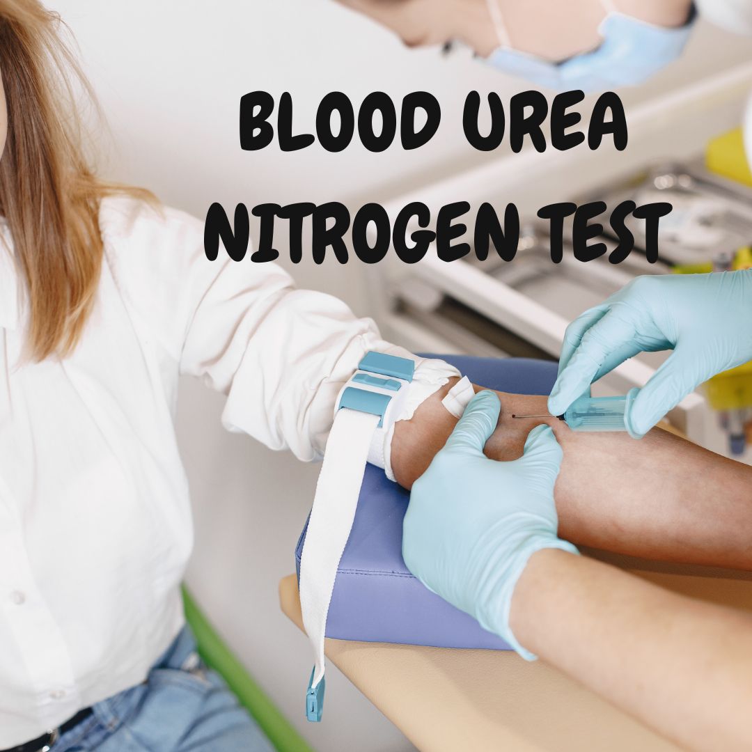 BUN Blood Urea Nitrogen Test - bigman lab