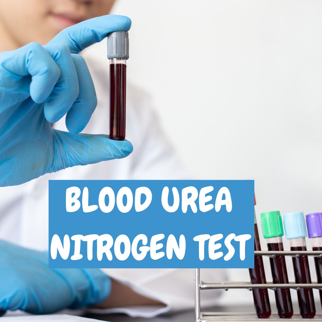 BUN Blood Urea Nitrogen Test - bigman lab