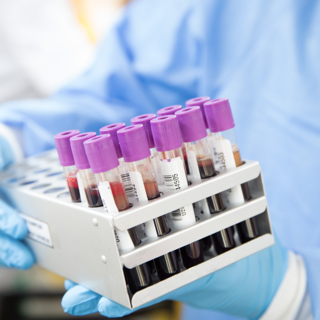 Best Complete Blood Count (CBC) Test Guide - bigman lab