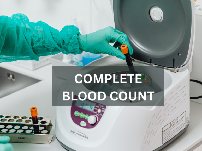 Best Complete Blood Count (CBC) Test Guide - bigman lab
